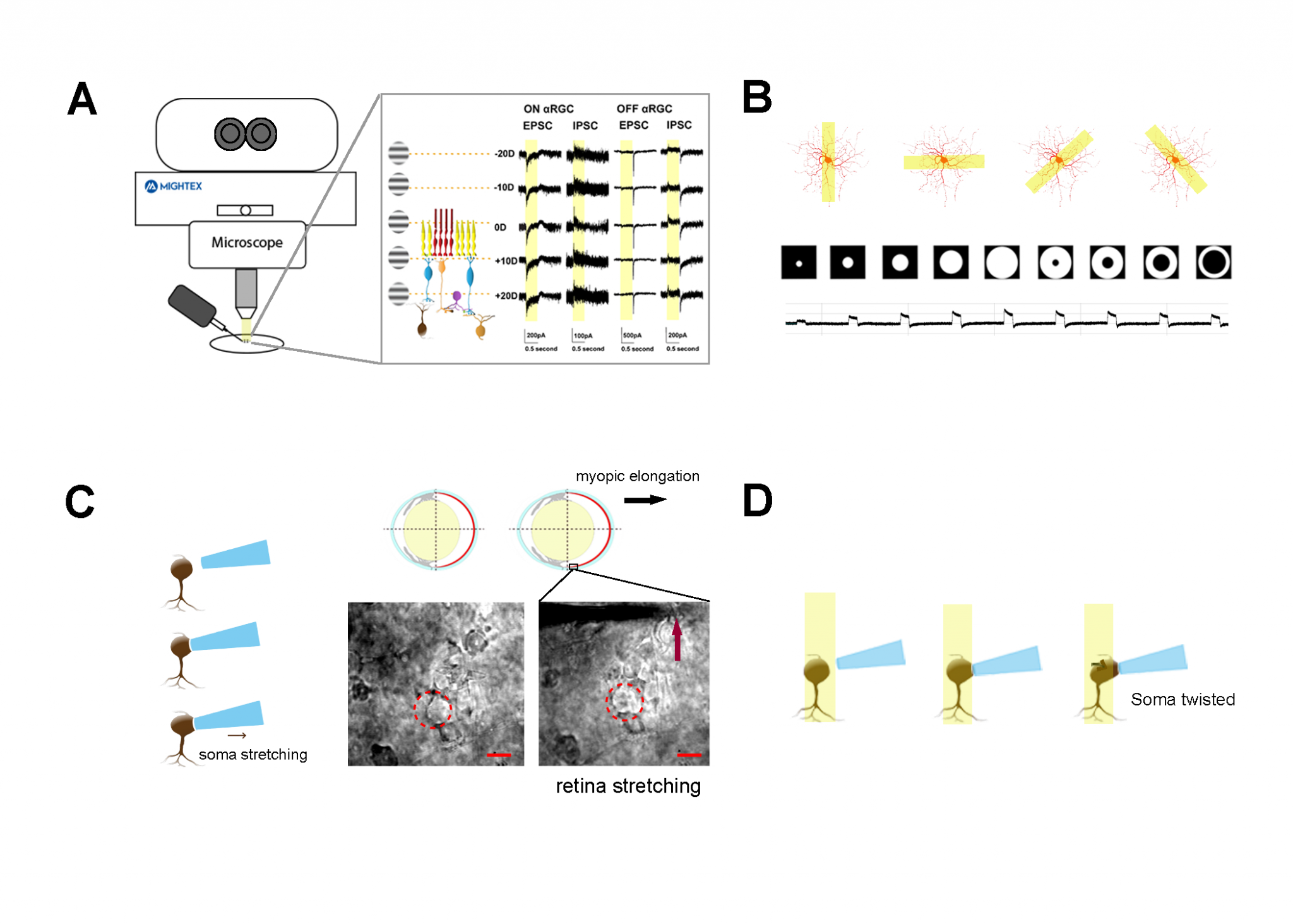 Exploration of the mechanism of refractive error in the mouse retina ...