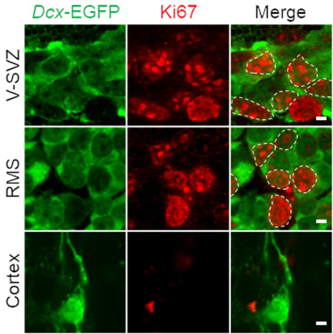 Spatial Biology with Patterned Illumination | Mightex | Stimulation and ...